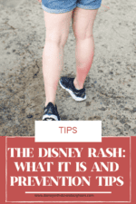 The Disney Rash Is Real! How to avoid and treat it.