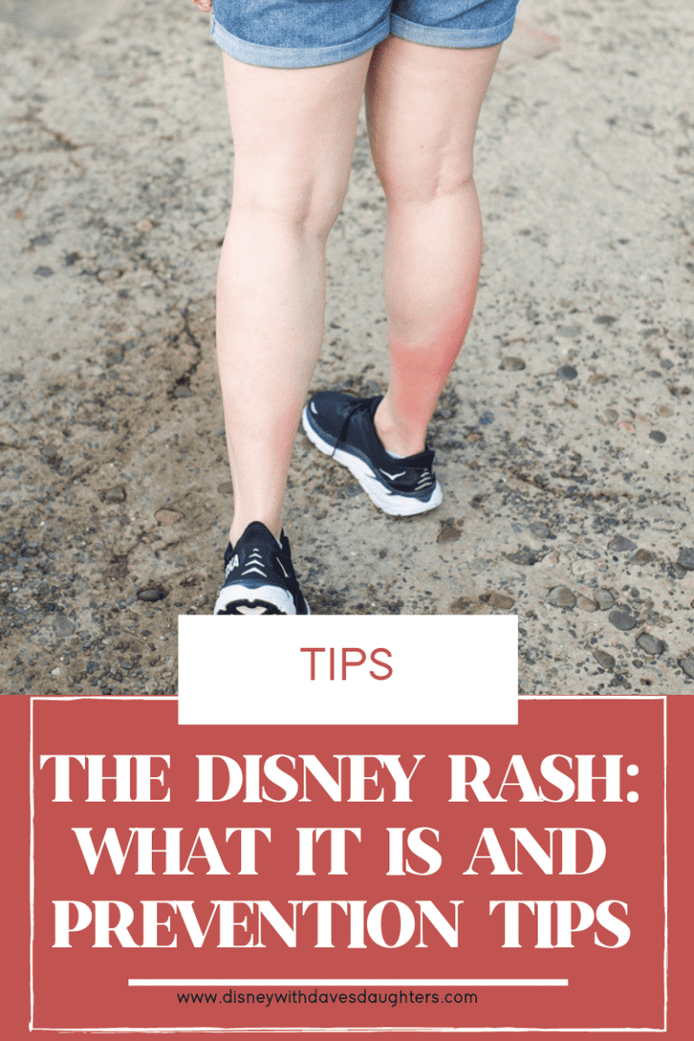 The Disney Rash Is Real! How to avoid and treat it.